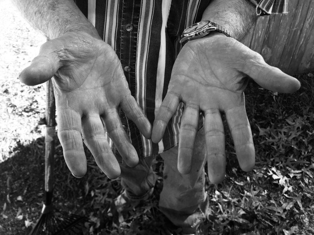 Blog - Busted Hands Along the Way | Lisa Cole